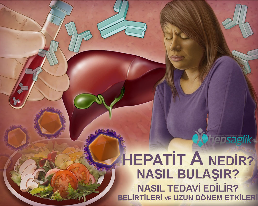 Hepatit A Nedir? Belirtileri ve Tedavisi | Sağlık - Hep Sağlık